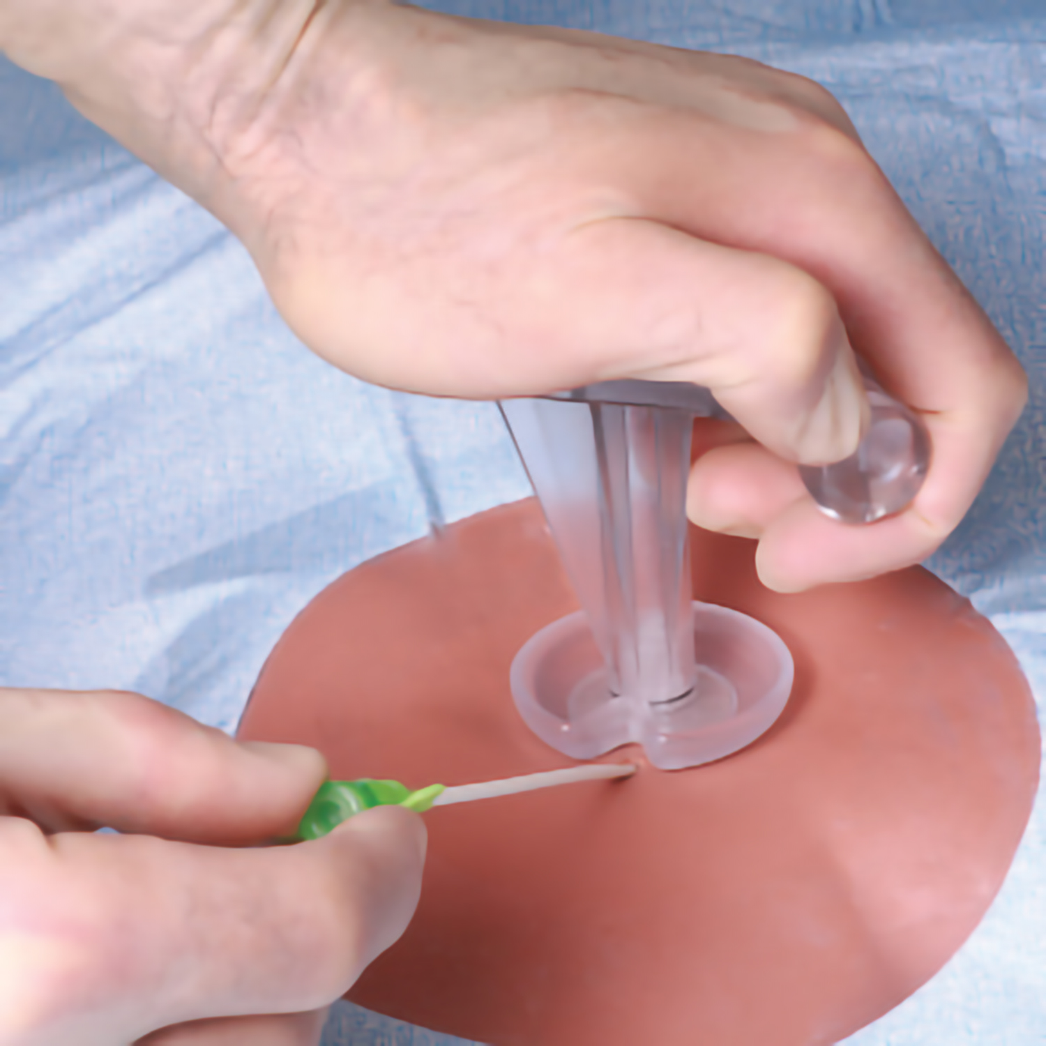 ITL BioMedical: Femoral Vascular Compression