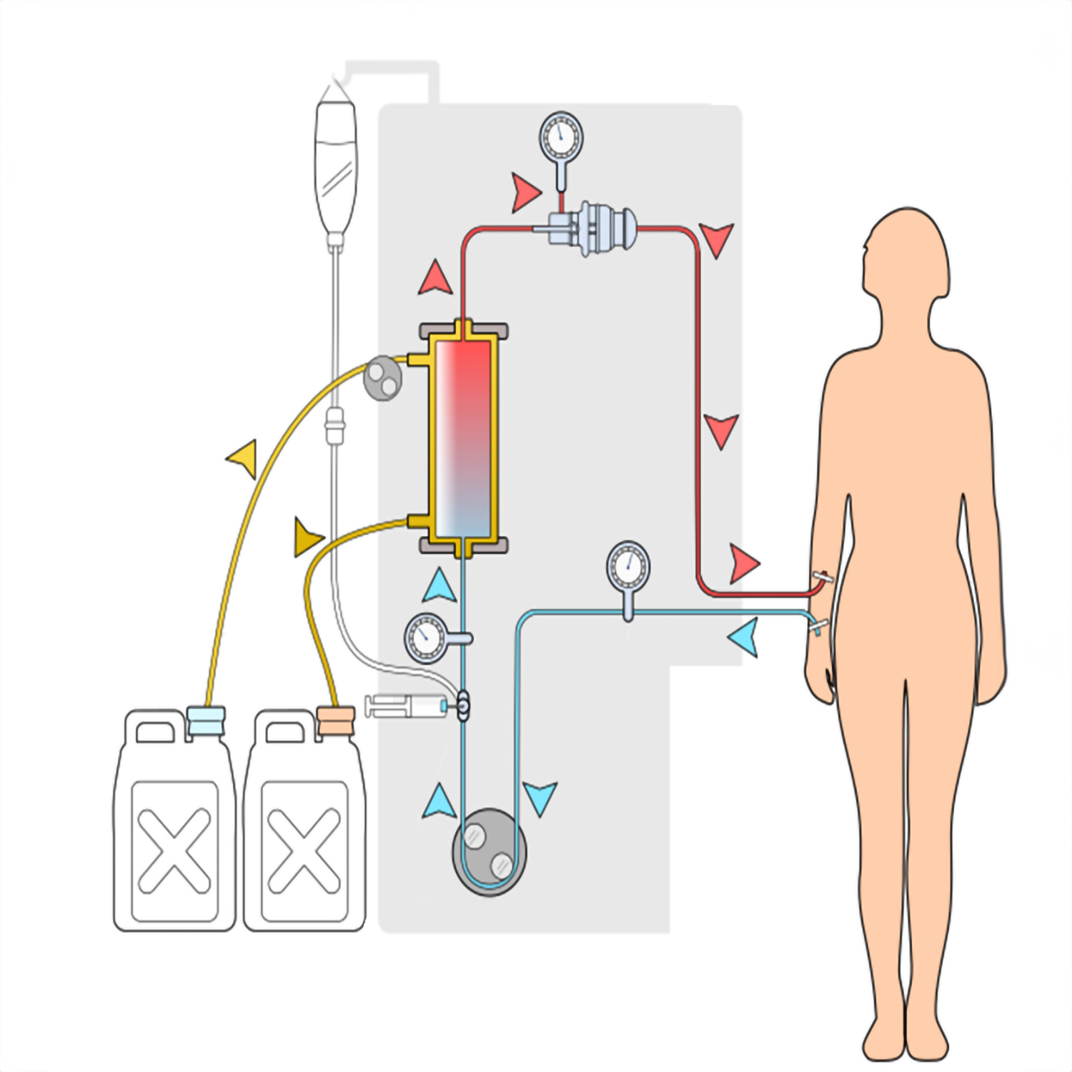 INTAGREL Dialysis Packs | Haemodialysis | ITL BioMedical